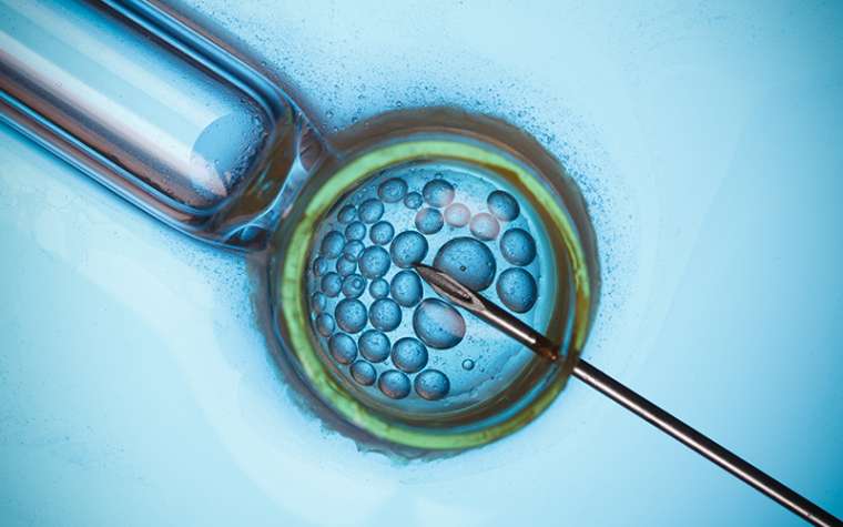 Mikro TESE, PESA Ve TESA Uygulamaları – Op. Dr. Seval Zeren Güngör